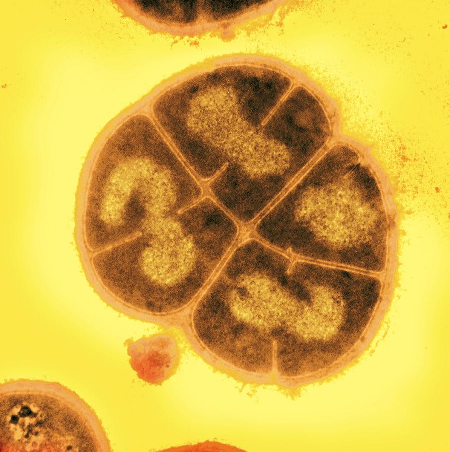 Radiation Resistant Bacteria, Sem #2 by Michael J Daly / Science Photo ...