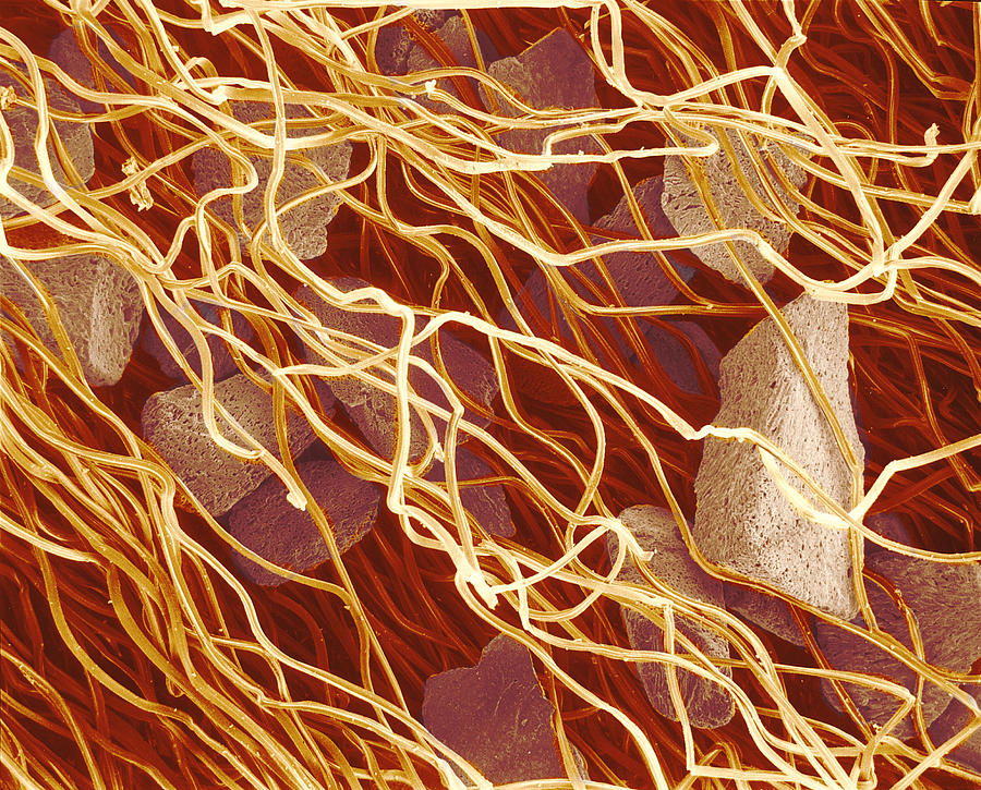 Cigarette Filter, Sem by Susumu Nishinaga / Science Photo Library