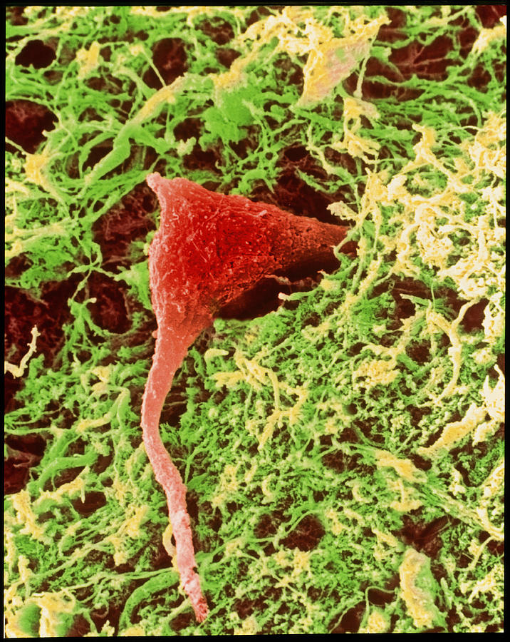 Coloured Sem Of A Nerve Cell In Brain Tissue by Steve Gschmeissner ...