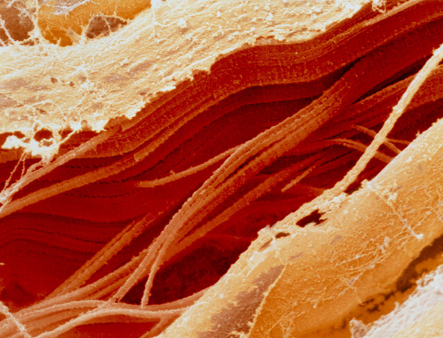 Coloured Sem Of Section Through Raw Meat by Power And Syred / Science ...