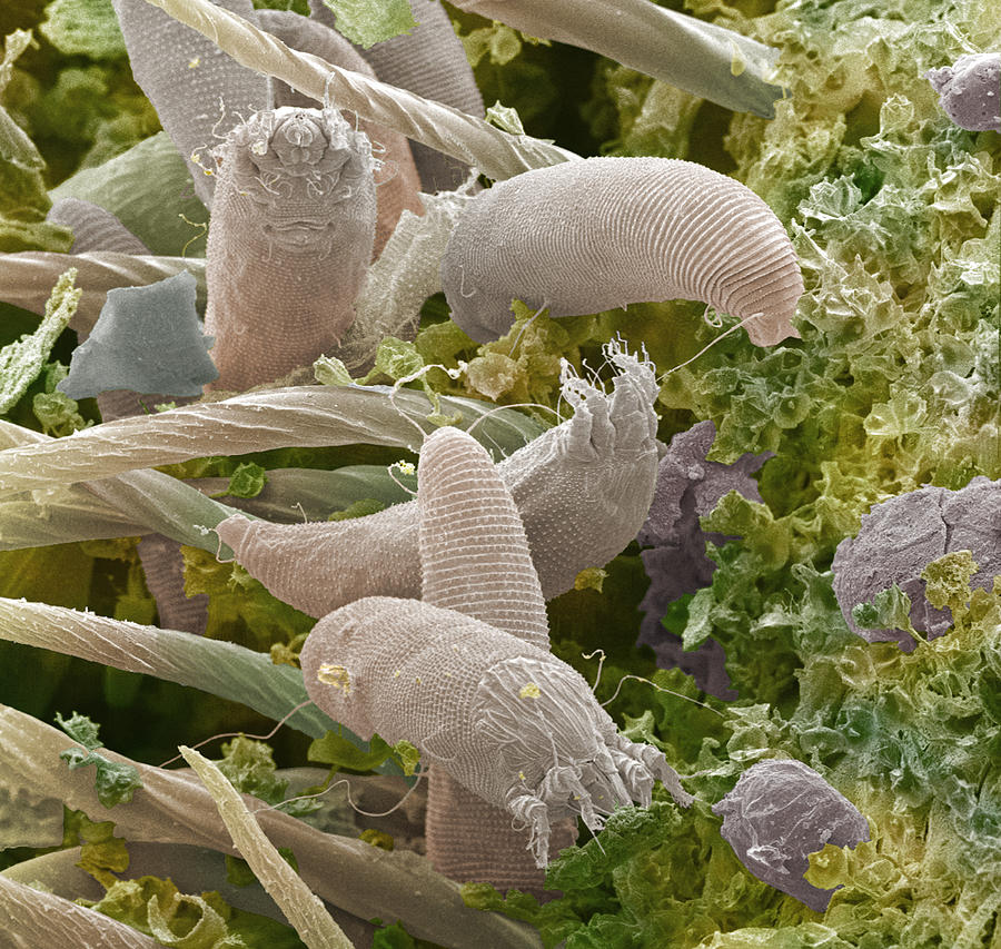 Gall Mites, Sem by Power And Syred / Science Photo Library