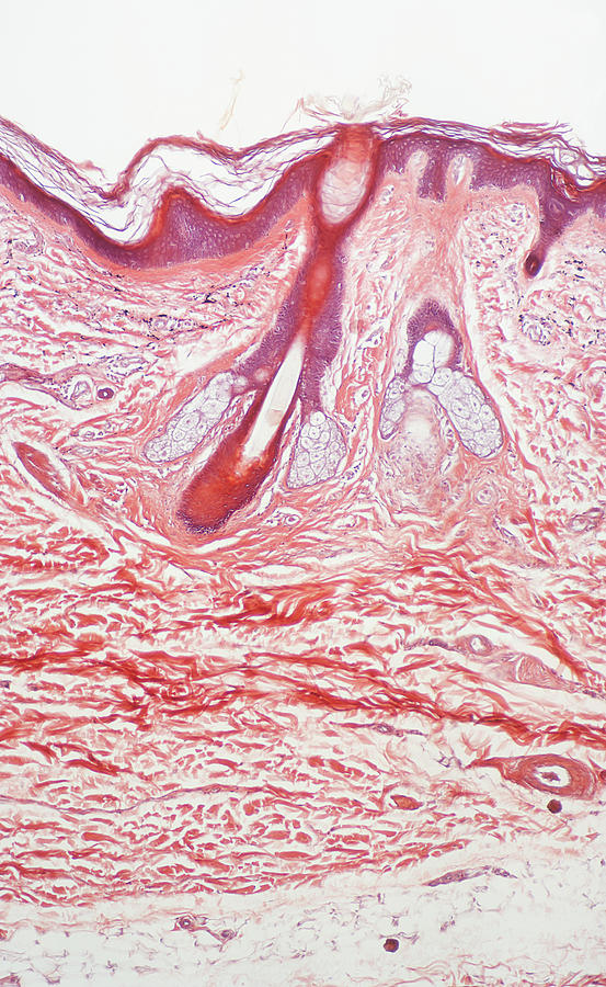 Human Skin Section, Light Micrograph by Power And Syred / Science Photo ...