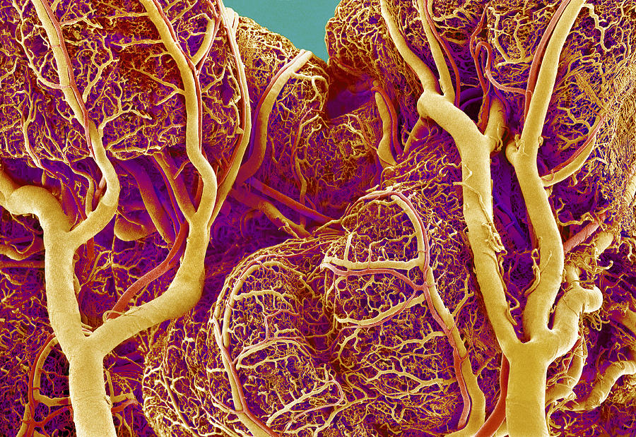 Small Intestine Blood Vessels, Sem by Susumu Nishinaga / Science Photo ...