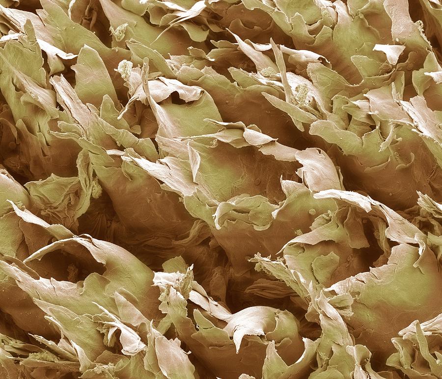 Squirrel Monkey Tongue, Sem by Steve Gschmeissner / Science Photo Library