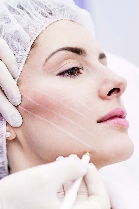 Drawing Marks On Woman's Face #1 Greeting Card by Science Photo Library