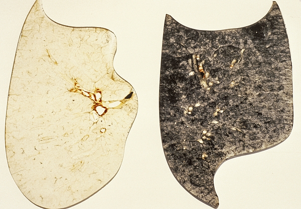 Normal And Smoker Lung Sections Greeting Card by Carolina Biological ...