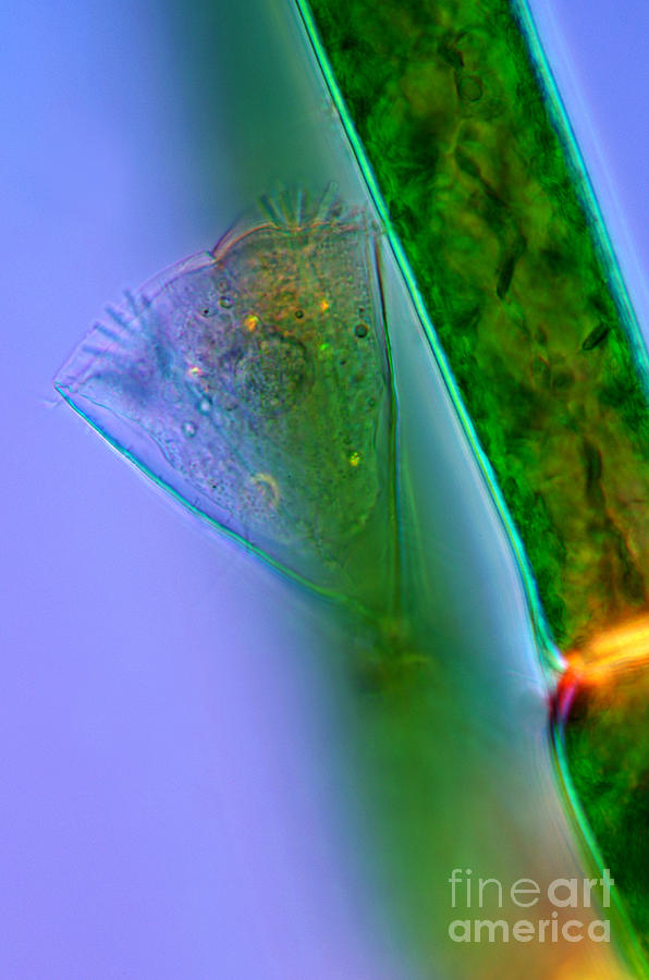 Suctoria Sp. Protozoan, Lm by Marek Mis