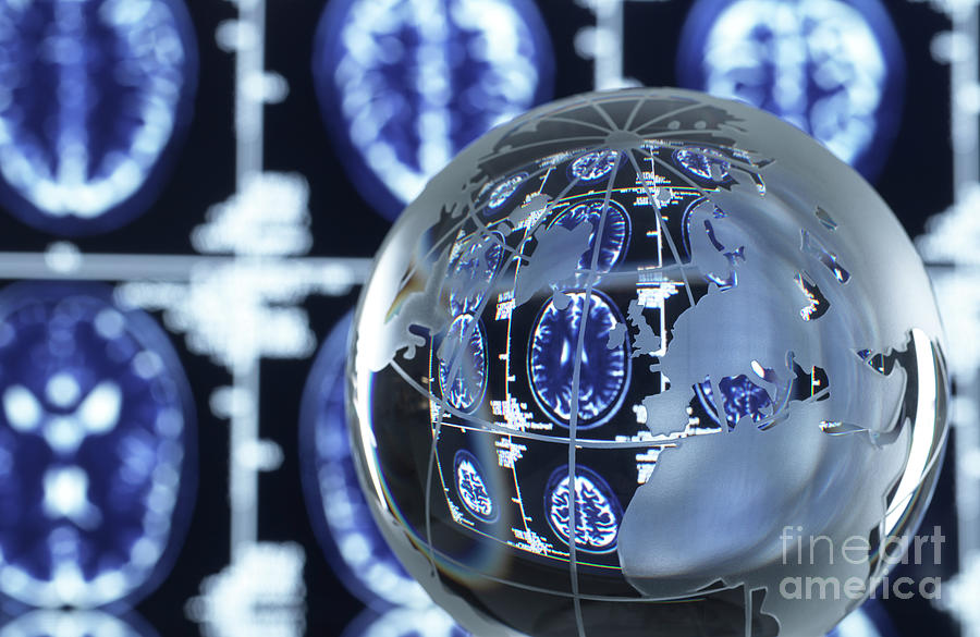 Brain Research #1 by Tek Image / Science Photo Library