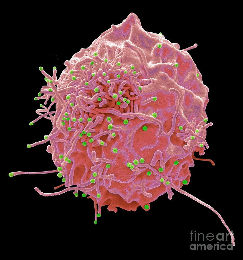 Hiv #1 by Steve Gschmeissner / Science Photo Library