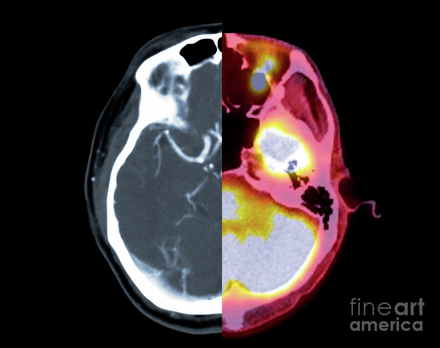 Normal Brain #1 by Samunella / Science Photo Library