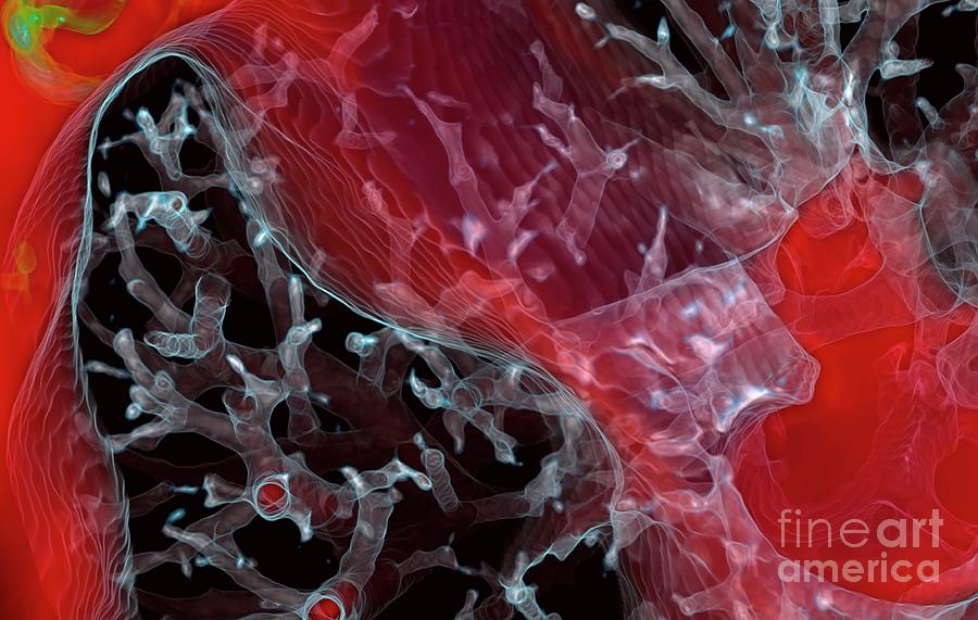 Lung Airways #19 by Vsevolod Zviryk / Science Photo Library