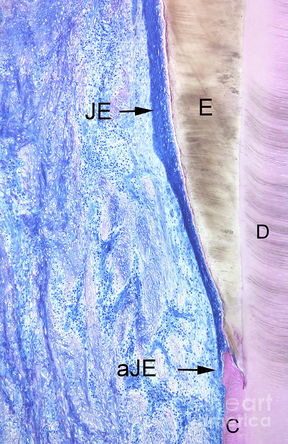 Human Junctional Epithelium #2 by Peter Schupbach / Science Photo Library