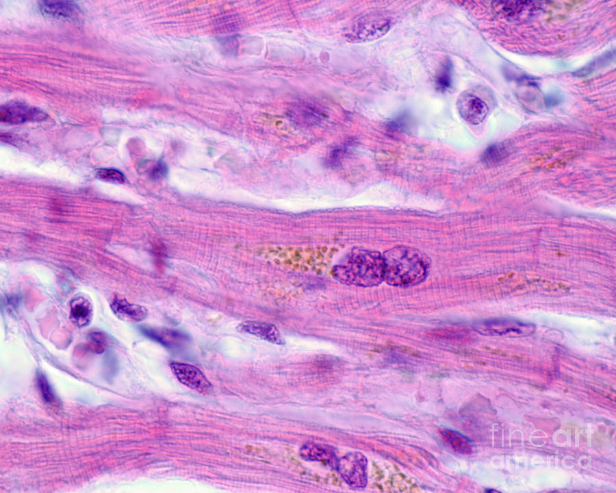 Lipofuscin In Heart Muscle Cells #2 by Jose Calvo / Science Photo Library