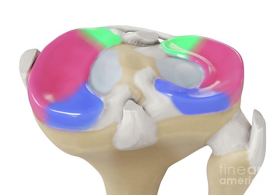 Meniscus Regions #2 by Medical Graphics / Michael Hoffmann / Science ...