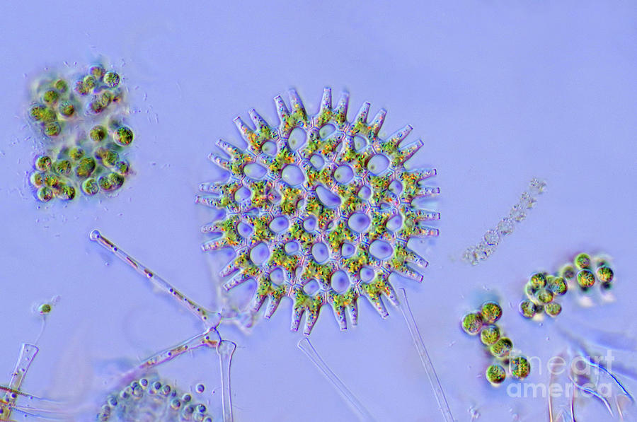 Pediastrum Green Algae #2 by Marek Mis / Science Photo Library