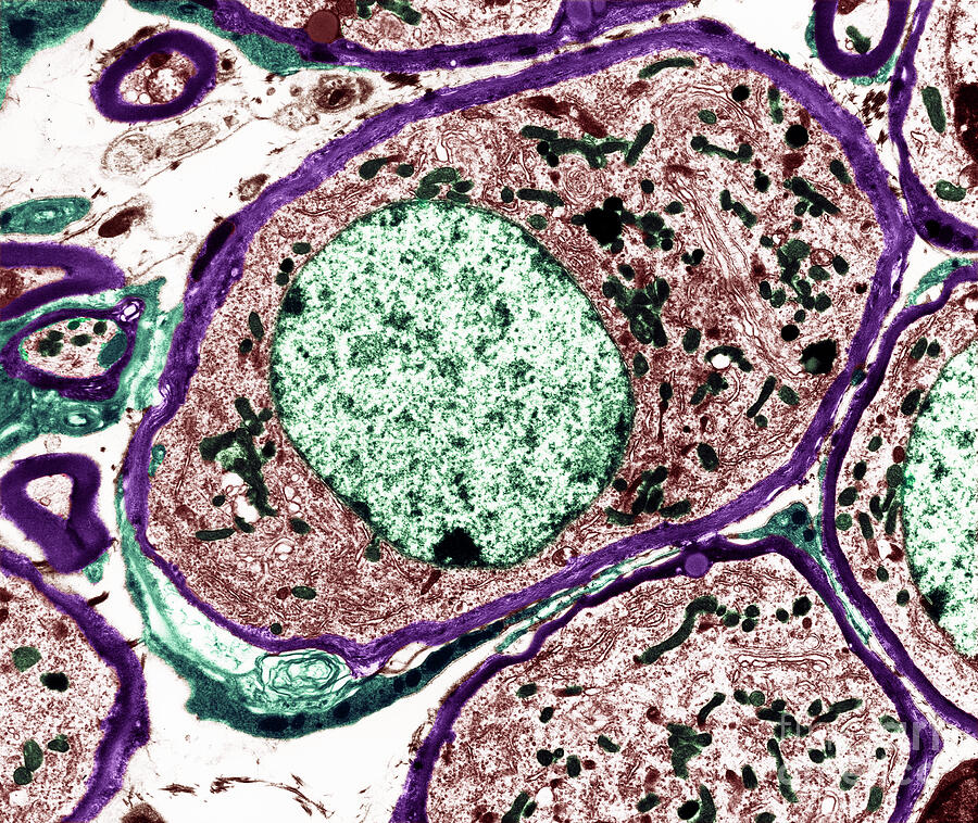 Spinal Root Ganglia Cells #2 by Steve Gschmeissner / Science Photo Library