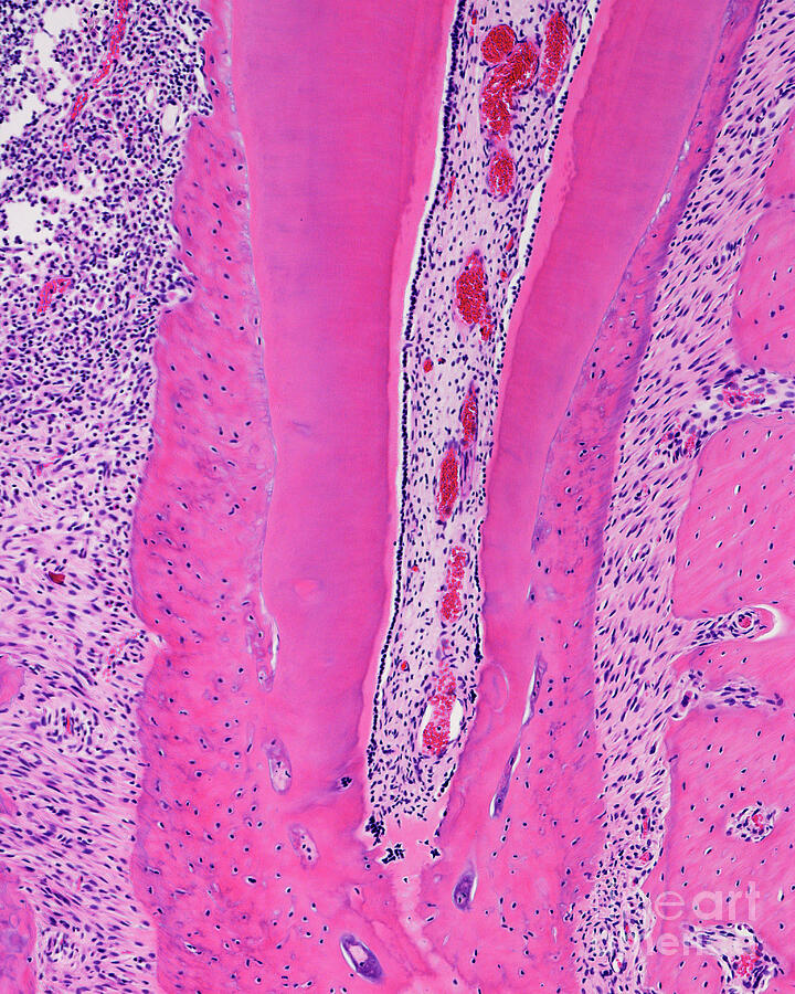 Tooth Root #2 by Jose Calvo / Science Photo Library