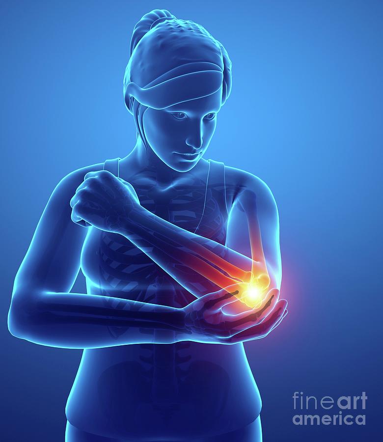 Woman With Elbow Pain #26 by Pixologicstudio / Science Photo Library