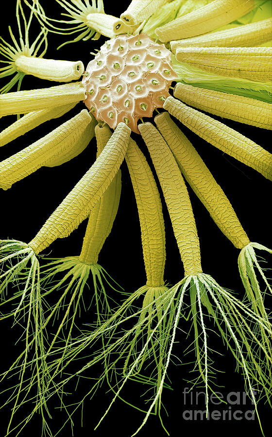 Daisy Seed Head #3 by Steve Gschmeissner / Science Photo Library