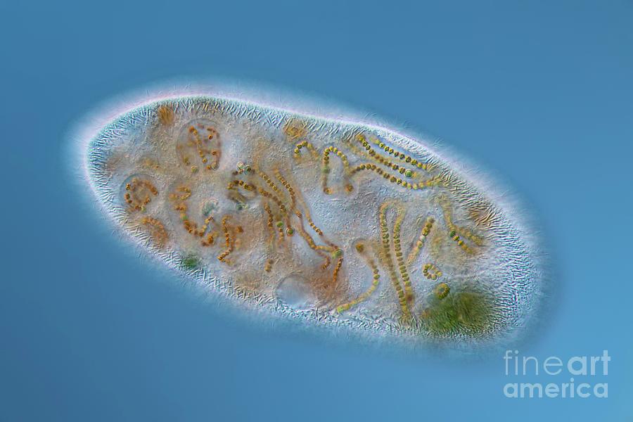 Frontonia Protist #3 by Frank Fox / Science Photo Library