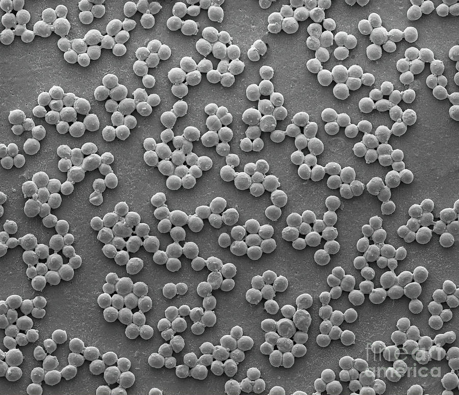 Group A Streptococcus Bacteria #3 by Steve Gschmeissner / Science Photo ...