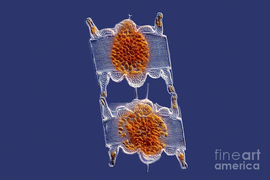 Odontella Sp. Algae #3 by Frank Fox / Science Photo Library