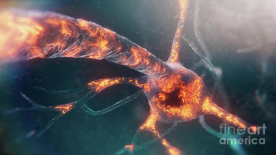 Tau And Neurofibrillary Tangles #3 by Hybrid Medical Animation ...