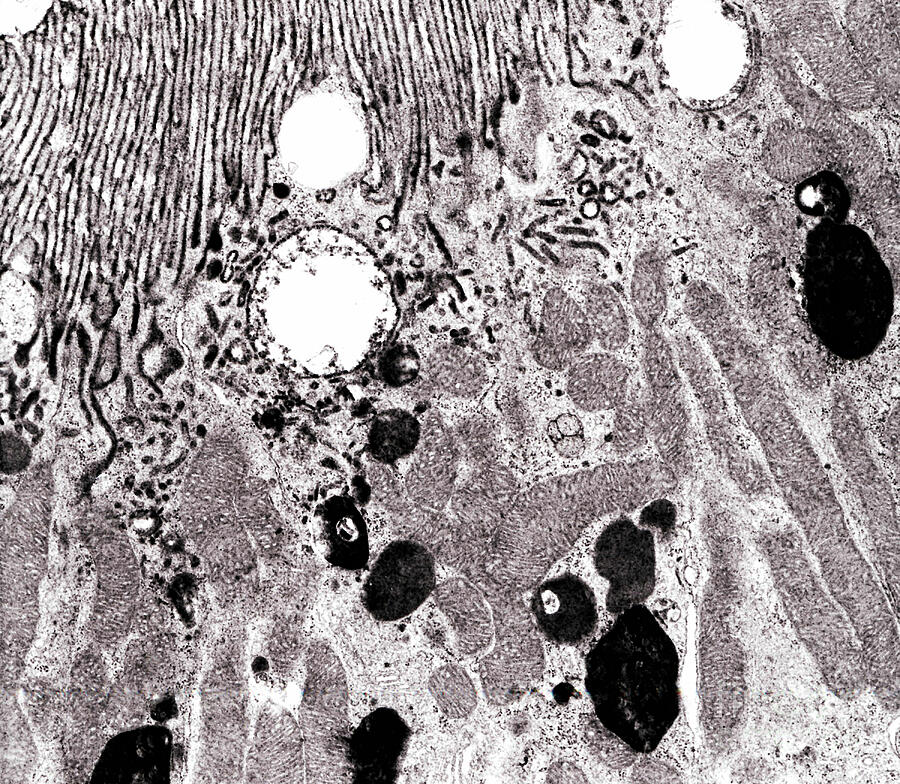Endocytosis In Kidney Proximal Tube #4 by Jose Calvo / Science Photo ...