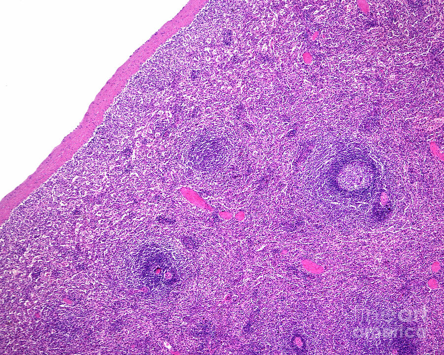 Human Spleen #5 by Jose Calvo / Science Photo Library