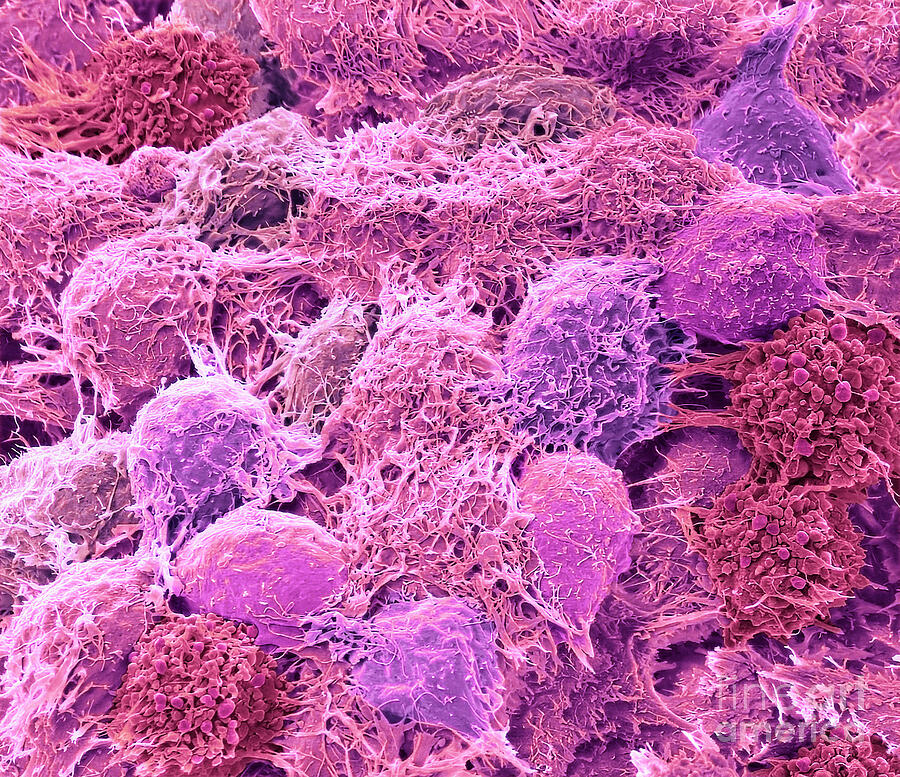 Hela Cells #6 by Steve Gschmeissner / Science Photo Library