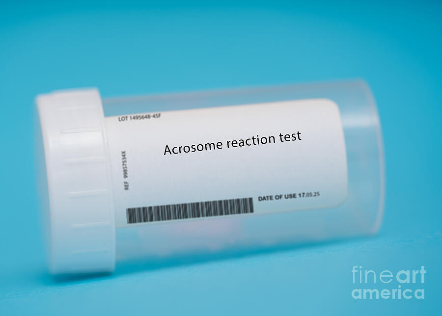 Acrosome Reaction Test by Wladimir Bulgar / Science Photo Library