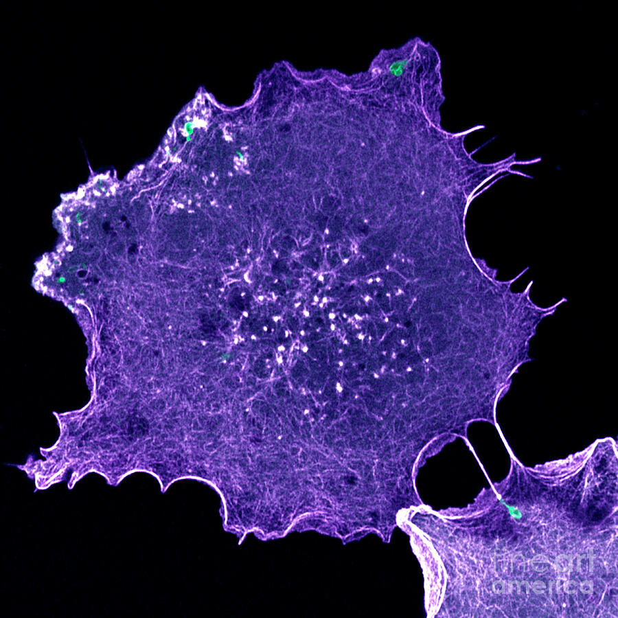 Actin Cytoskeleton by Thebiocosmos / Science Photo Library