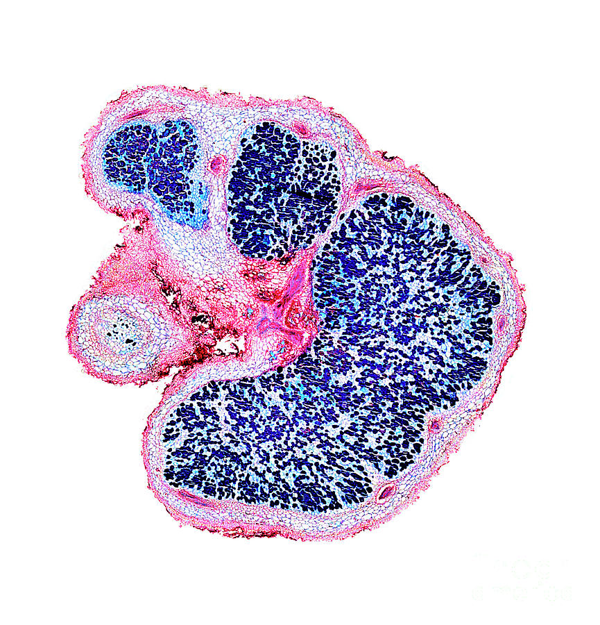 Broad Bean Root Nodules by Dr Keith Wheeler / Science Photo Library