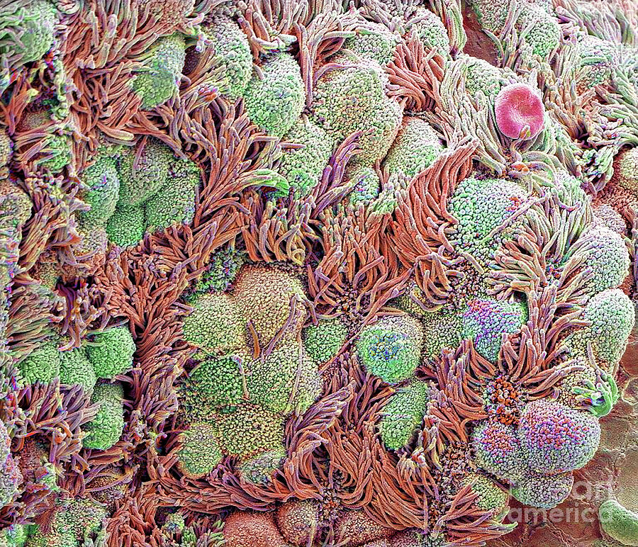 Bronchus by Steve Gschmeissner / Science Photo Library