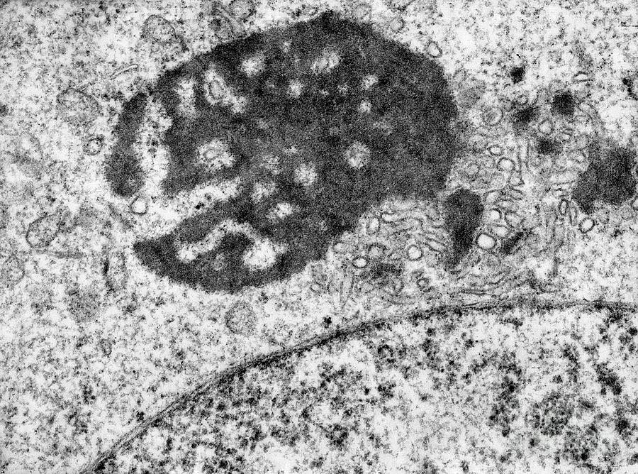 Chromatoid Body by Jose Calvo / Science Photo Library