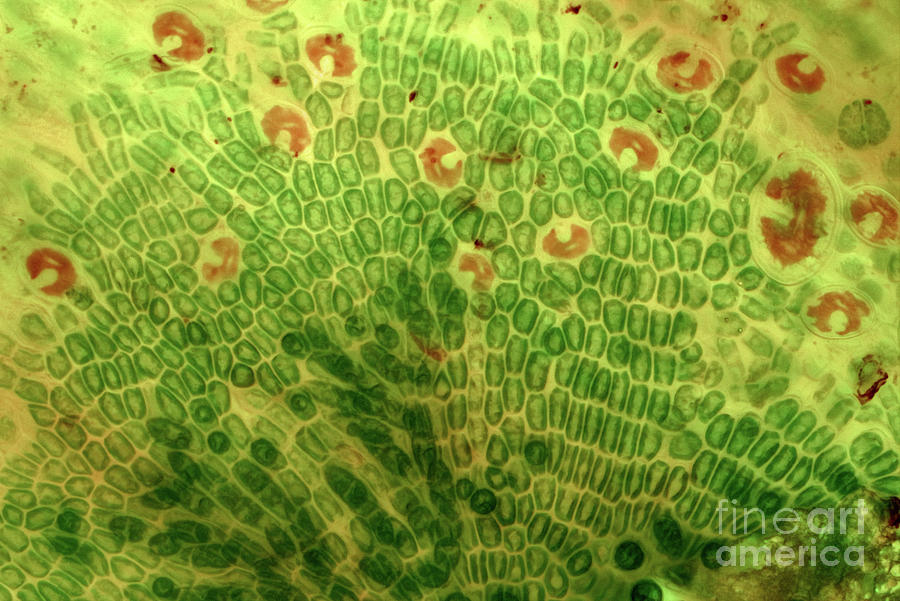 Green Algae And Cocconeis Sp. Diatoms by Marek Mis / Science Photo Library