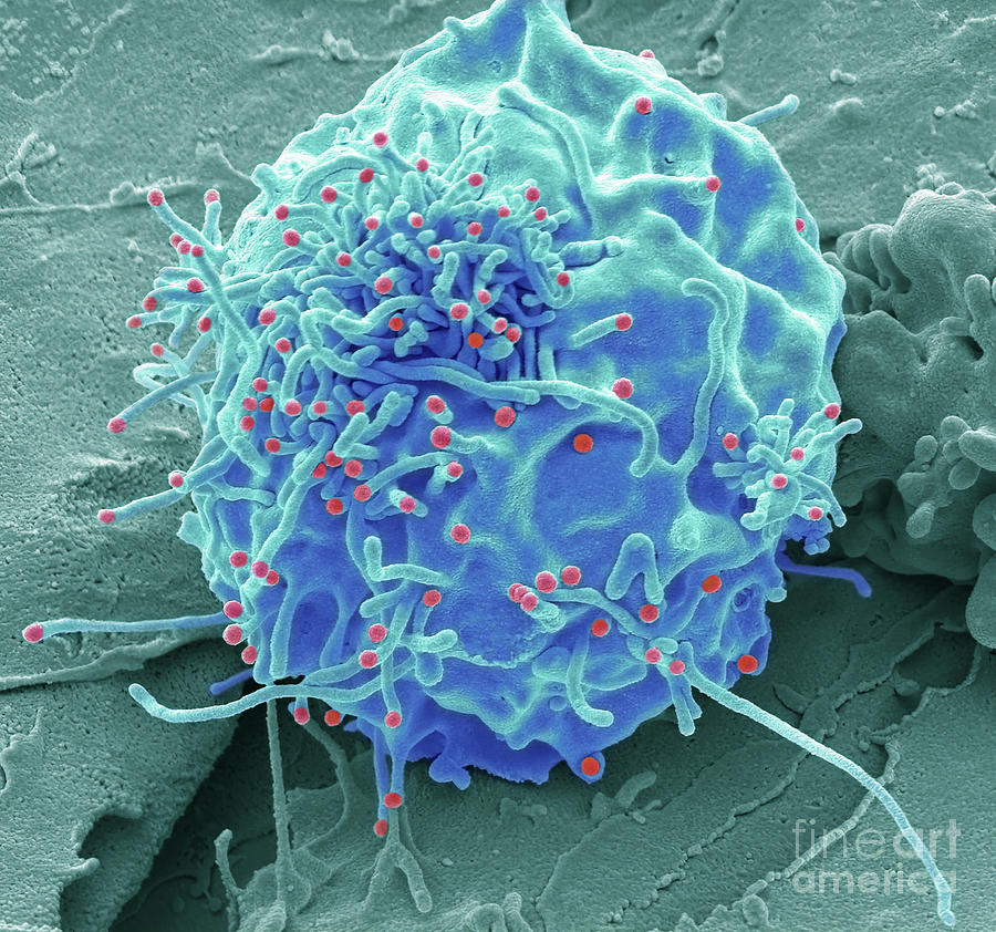 Hiv by Steve Gschmeissner / Science Photo Library