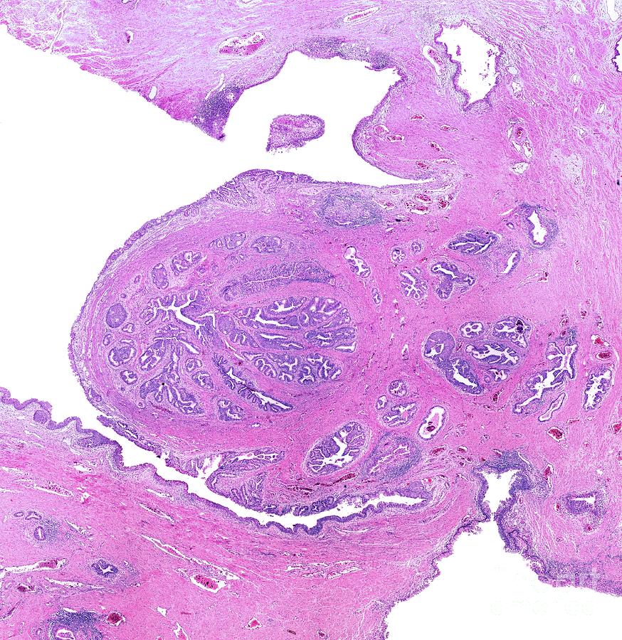 Human Seminal Colliculus by Jose Calvo / Science Photo Library