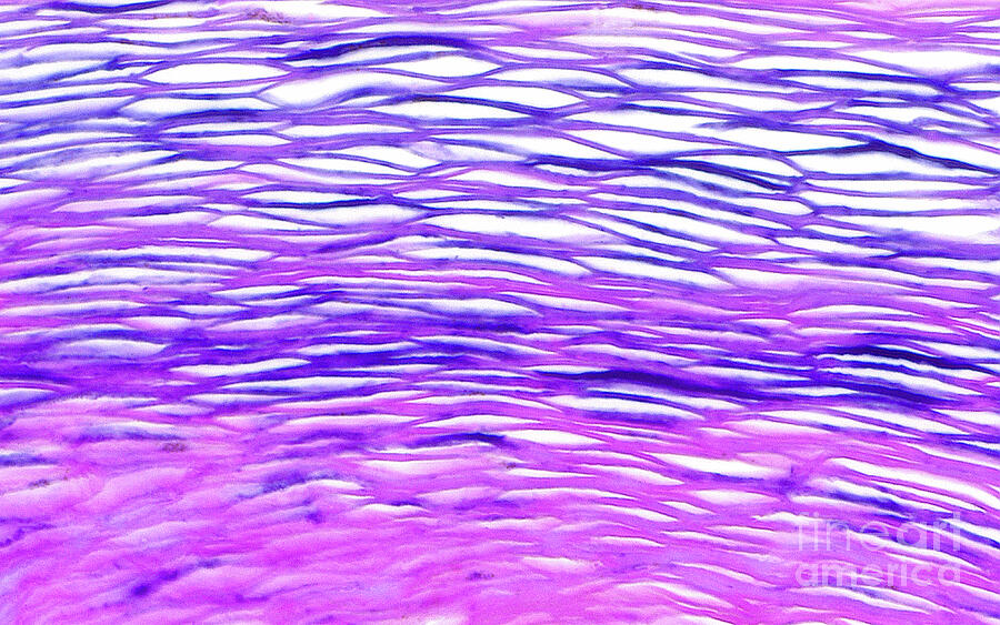 Keratin From Skin Cyst by Ziad M. El-Zaatari / Science Photo Library