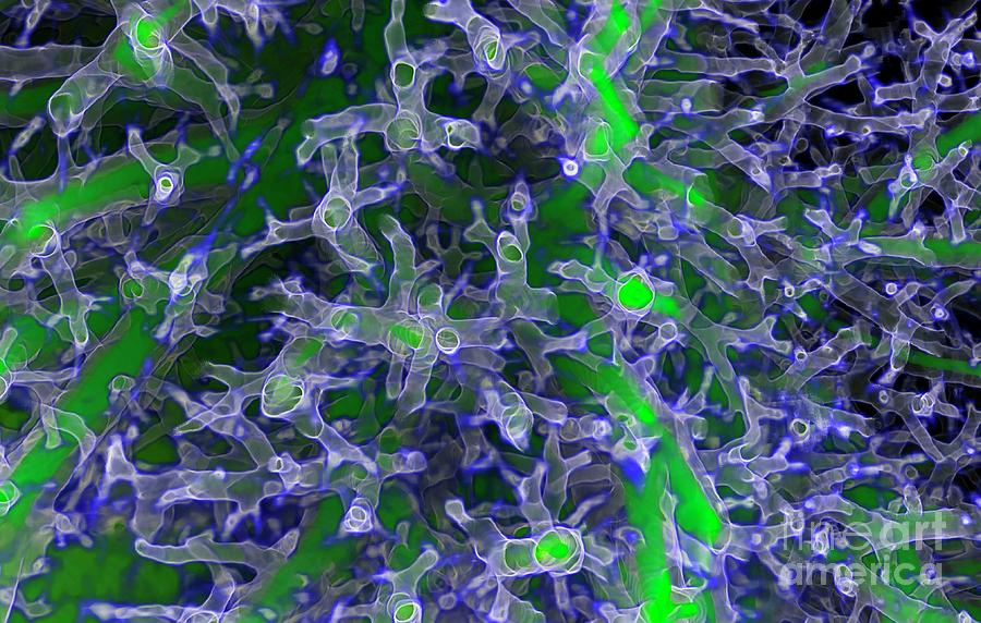 Lung Airways by Vsevolod Zviryk / Science Photo Library
