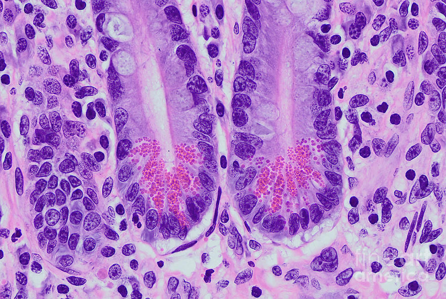 Paneth Cell by Microscape / Science Photo Library