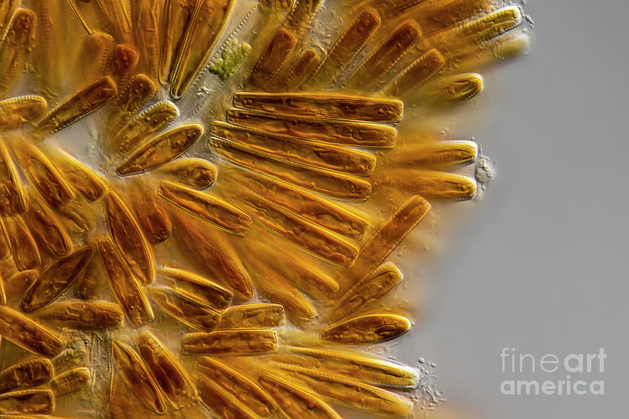 Rhoicosphenia Sp. Algae by Frank Fox / Science Photo Library