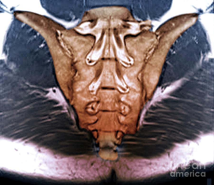 Sacrum by Zephyr / Science Photo Library