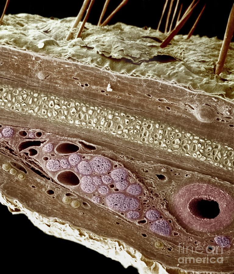 Skin Cross-section by Dr. Richard Kessel and Dr. Randy Kardon / Science ...