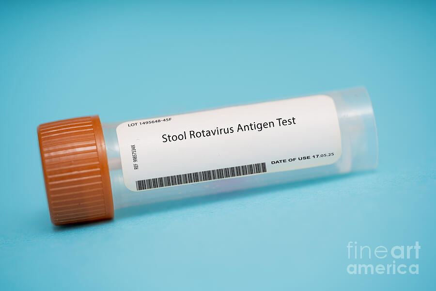 Stool Rotavirus Antigen Test by Wladimir Bulgar / Science Photo Library