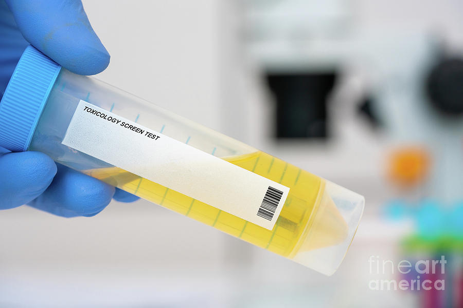 Urine Sample by Wladimir Bulgar / Science Photo Library