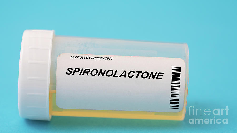Urine Test For Spironolactone by Wladimir Bulgar / Science Photo Library